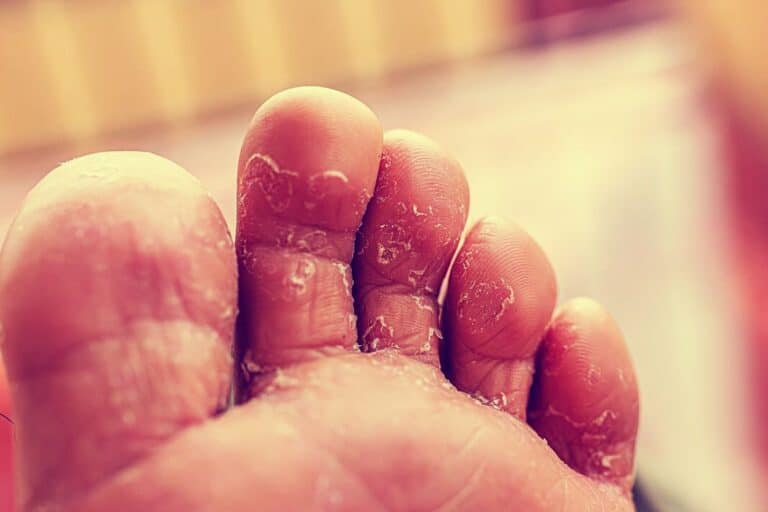 Pé de Atleta | PodologiaTop.com